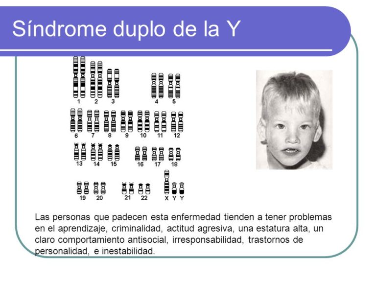 Síndrome XYY